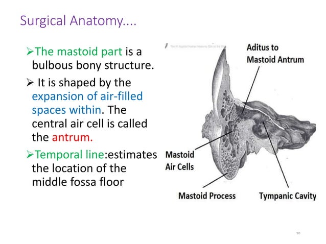 MASTOIDECTOMY PPT | PPT | Ear, Nose and Throat Conditions | Diseases ...