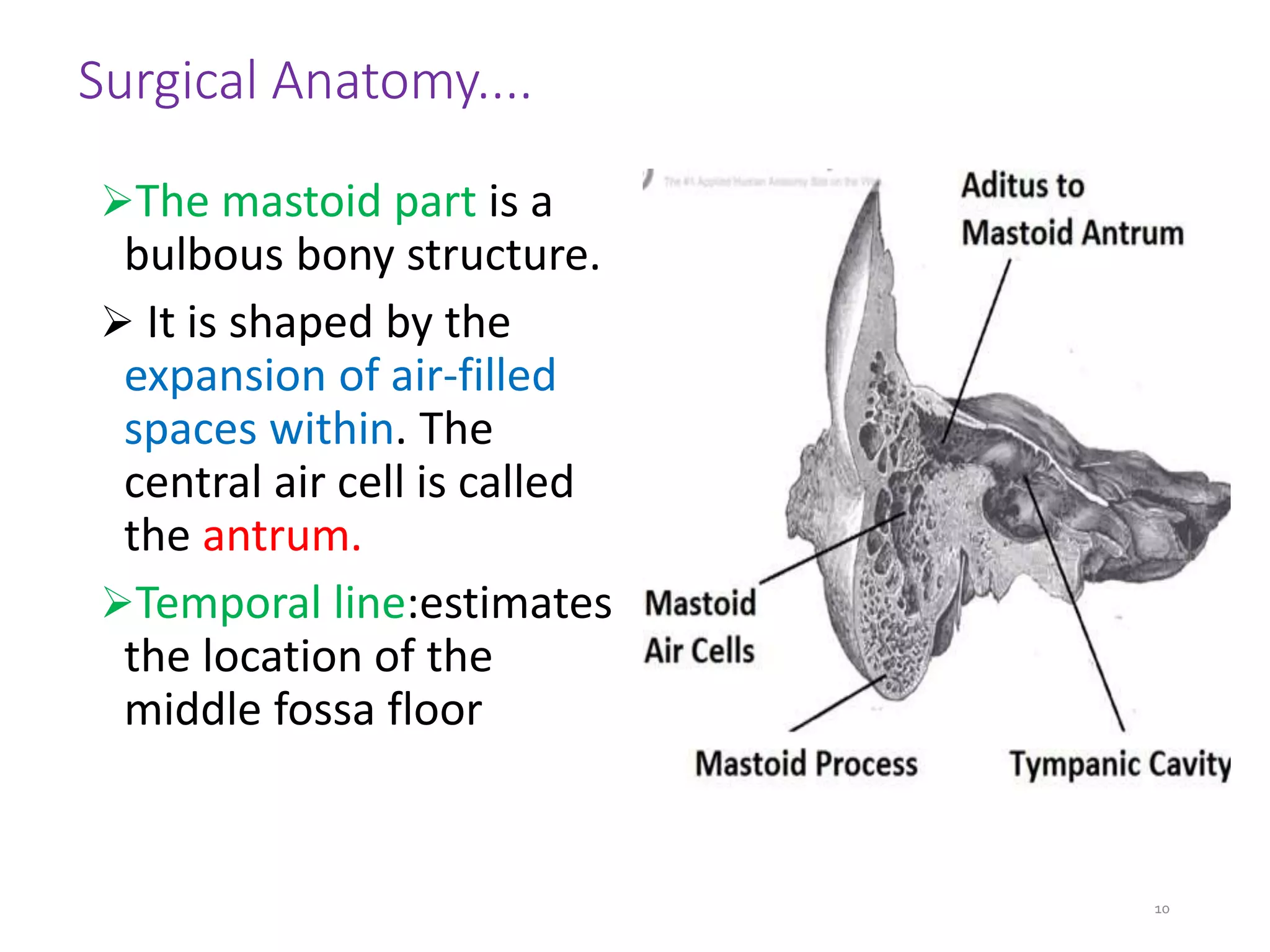 MASTOIDECTOMY PRESENTATION | PPT