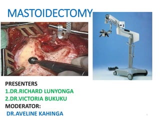 MASTOIDECTOMY PRESENTATION | PPT