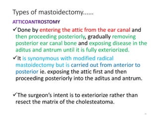 MASTOIDECTOMY PRESENTATION | PPT