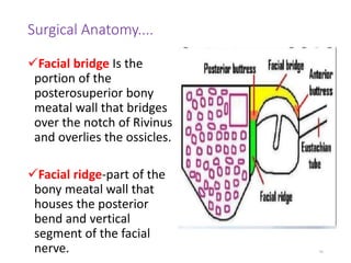 MASTOIDECTOMY PRESENTATION | PPT