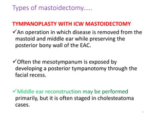 MASTOIDECTOMY PRESENTATION | PPT