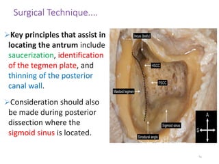 MASTOIDECTOMY PRESENTATION | PPT