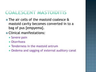 Mastoiditis | PPTX