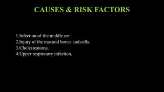 Mastoiditis | PPT