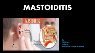 Mastoiditis In Adults