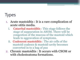 Mastoiditis | PPTX