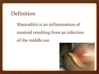 Mastoiditis | PPTX | Ear, Nose and Throat Conditions | Diseases and ...