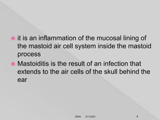 Mastoiditis.ppt