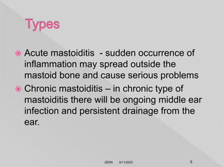 Mastoiditis.ppt
