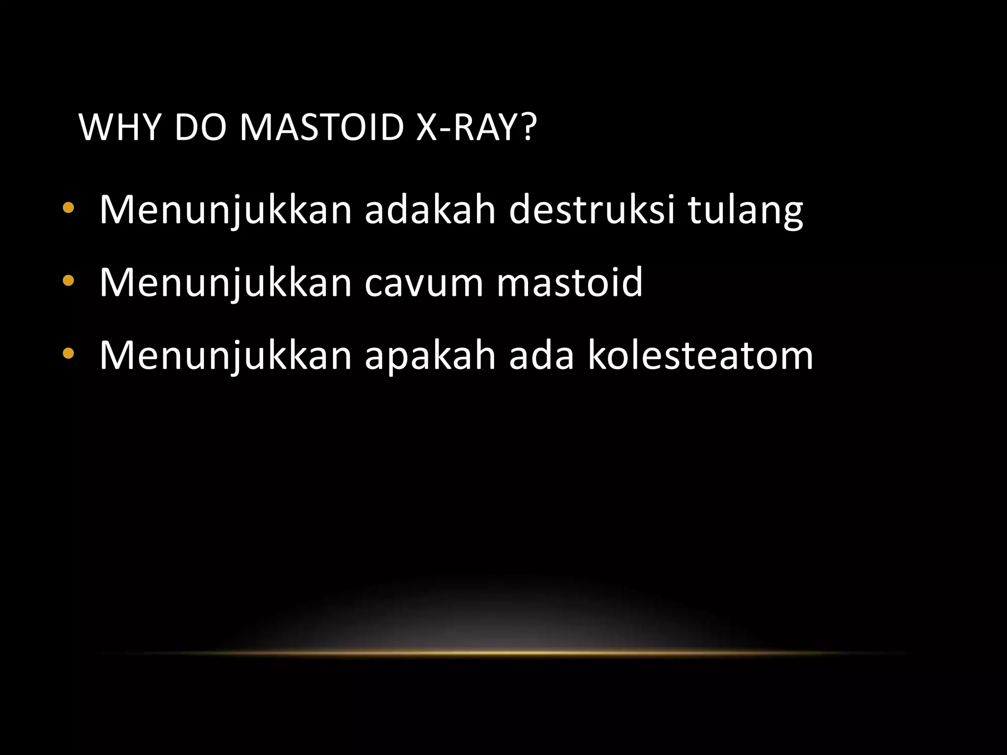 MASTOIDITIS.pptx