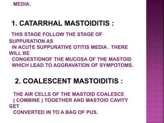 mastoiditis.pptx