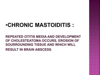 mastoiditis.pptx