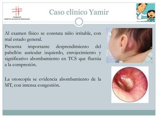 Tratamiento de la mastoiditis - XXVII Jornada Pediatría | PDF