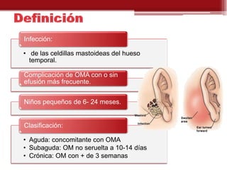 MASTOIDITIS AGUDA | PPTX