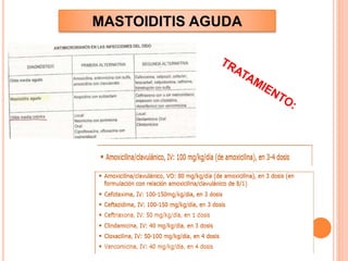 Mastoiditis aguda | PPTX