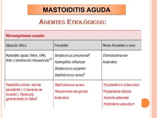 Mastoiditis aguda | PPTX