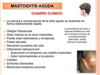 Mastoiditis aguda | PPTX