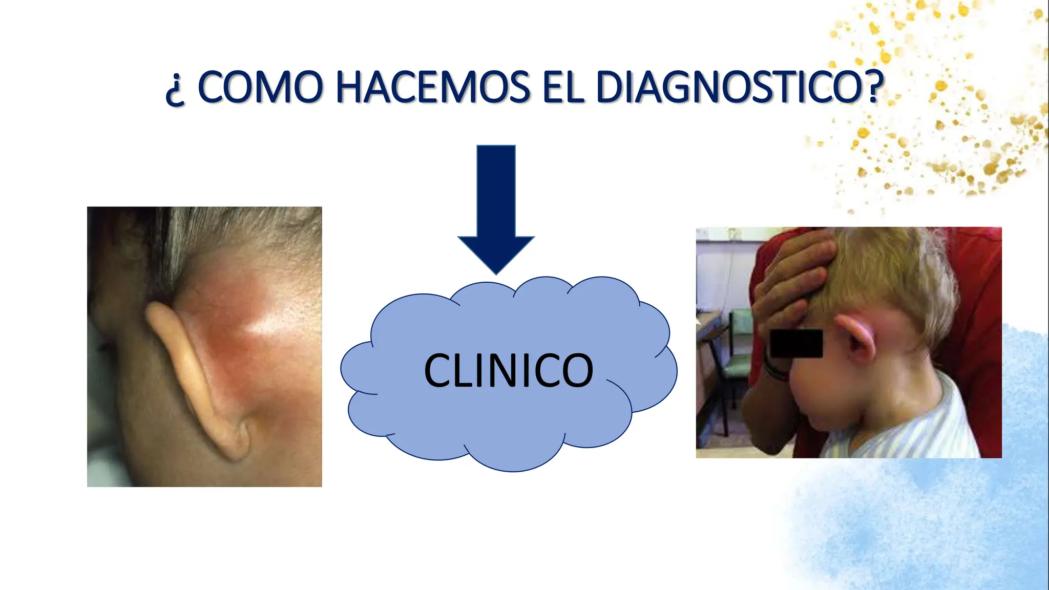 MASTOIDITIS AGUDA EN NIÑOS. Definicion, clasificacion y tratamiento | PPTX