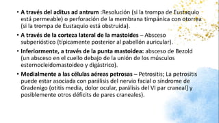 MASTOIDITIS AGUDA EN NIÑOS. Definicion, clasificacion y tratamiento | PPTX