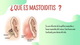 QUE ES LA MASTOIDITIS? QUE ES LO QUE OCASIONA | PDF
