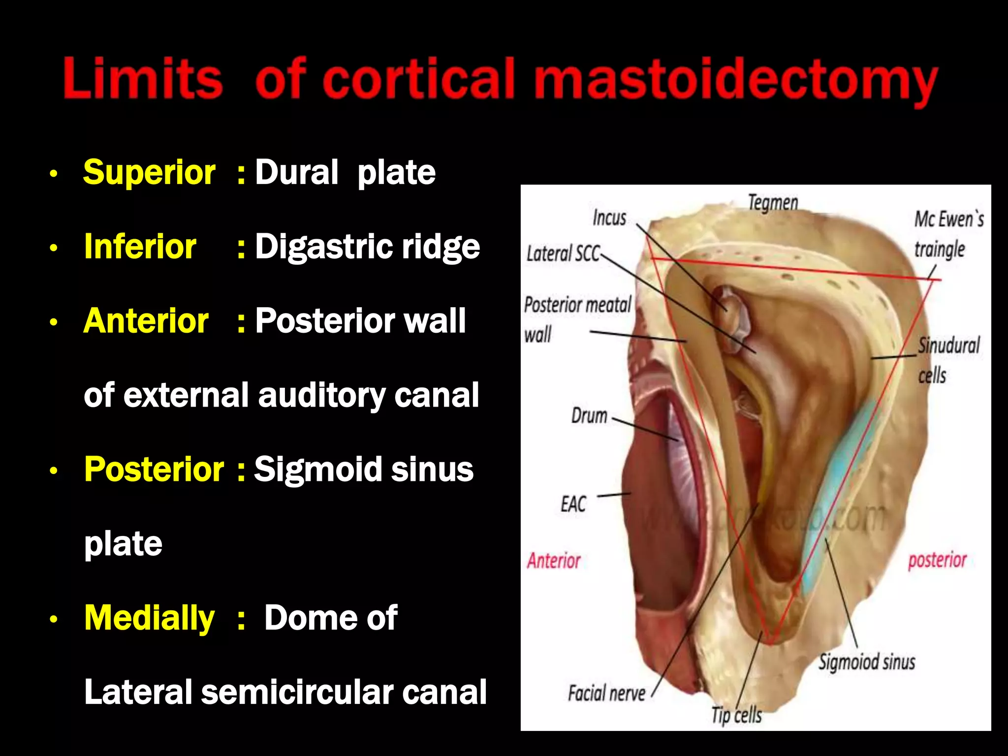 Mastoid surgeries KK .ppt