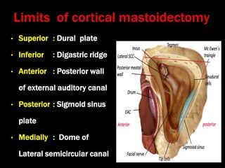 Mastoid surgeries KK .ppt