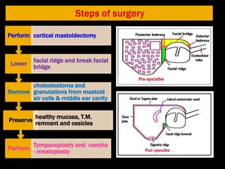 Mastoid surgeries KK .ppt