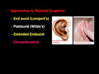 Mastoid surgeries KK .ppt