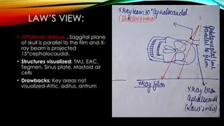 Comprehensive Mastoid X-Ray Imaging Techniques and Views Explained | PPTX