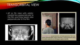 Comprehensive Mastoid X-Ray Imaging Techniques and Views Explained | PPTX