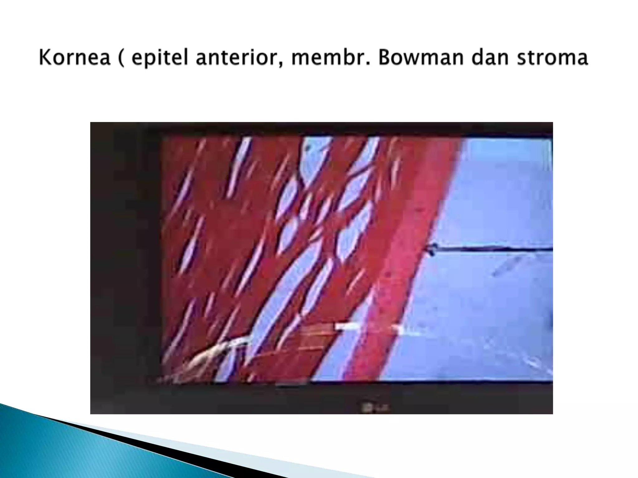 histologi mata (modul organ sensoris) | PPTX