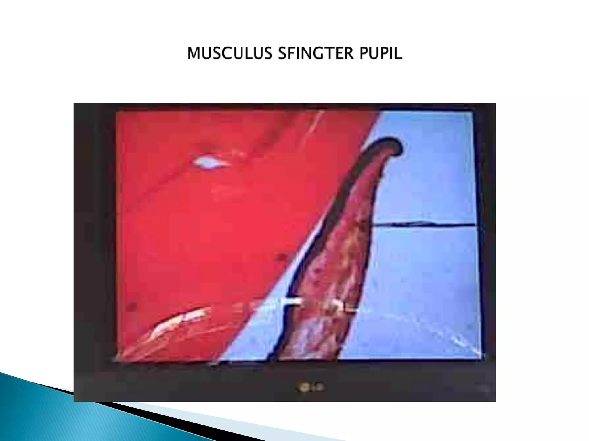 histologi mata (modul organ sensoris) | PPTX