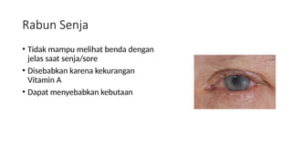 Materi IPAS Bagian-Bagian Mata, penyakit pada mata dan sifat-sifat ...