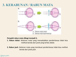 MATA TELINGA.ppt