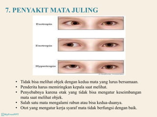 MATA TELINGA.ppt