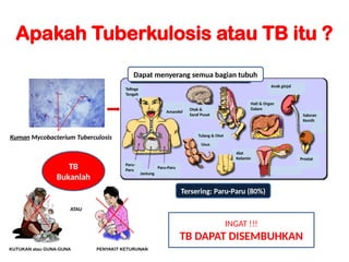 materi dasar tatalaksana tuberkulosis untuk umum | PPT