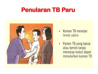 materi dasar tatalaksana tuberkulosis untuk umum | PPT