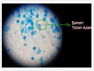MIKROBIOLOGI: BAKTERI | PPT