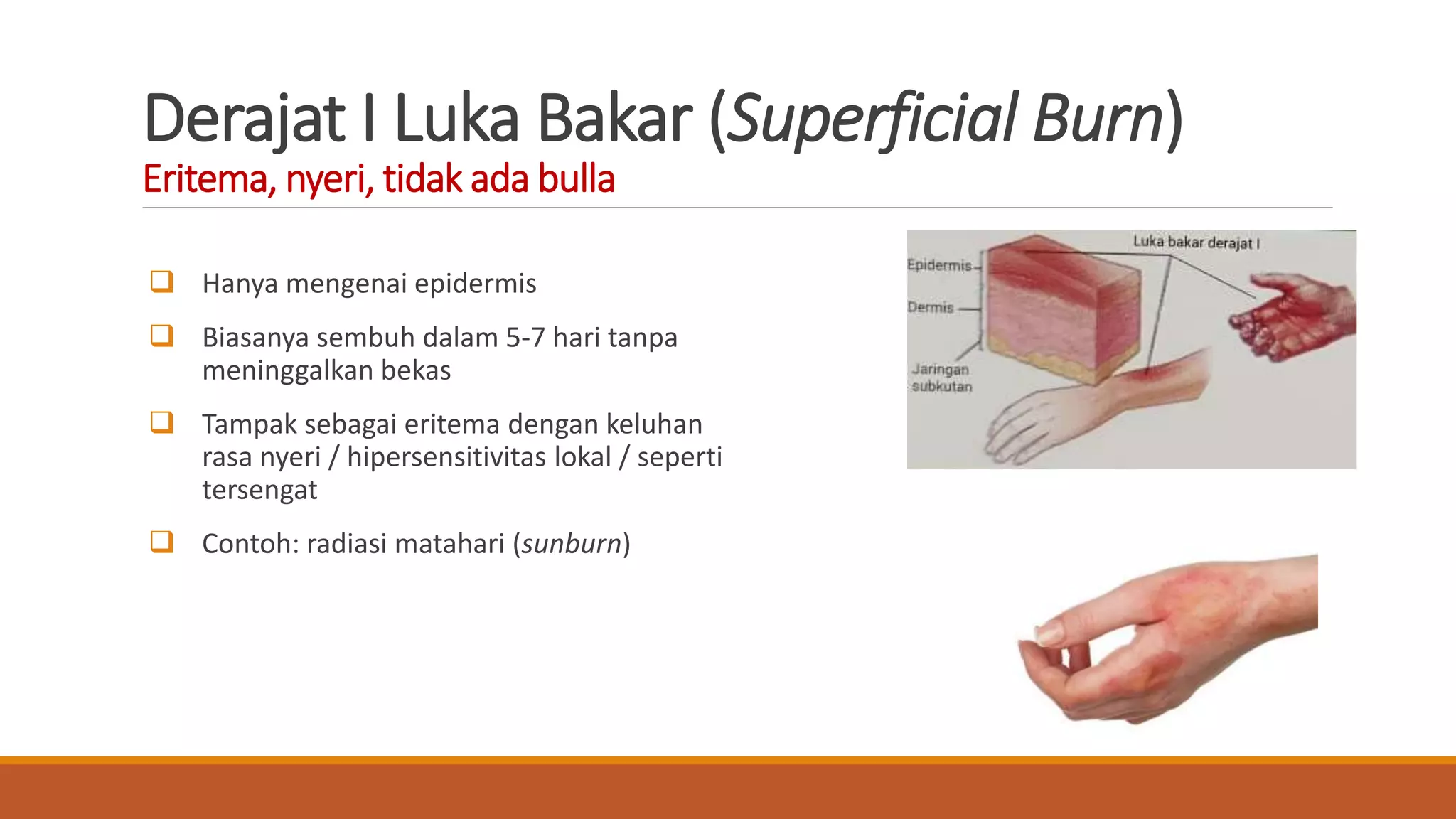 Materi 1_Konsep luka bakar.pptx
