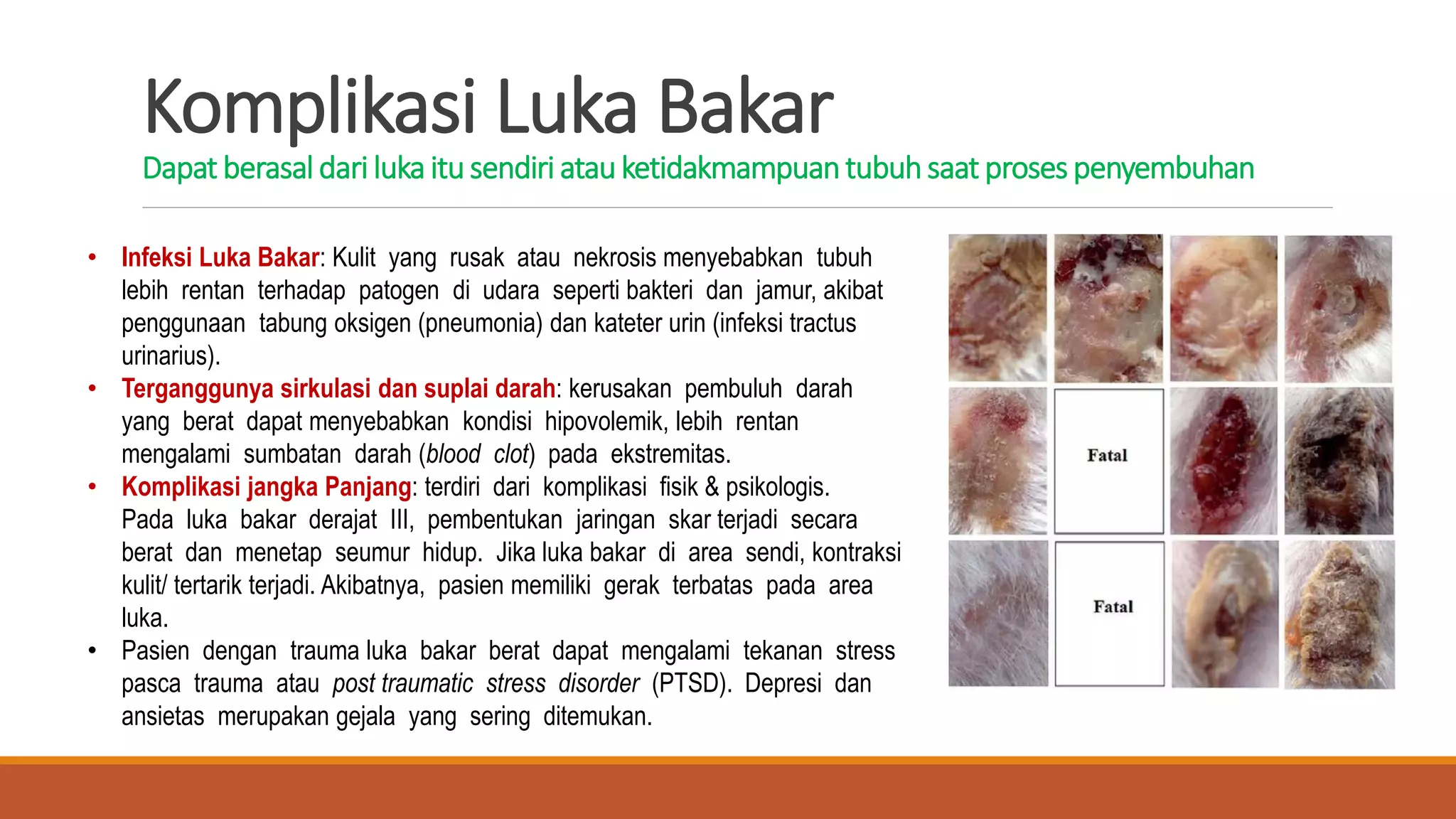 Materi 1_Konsep luka bakar.pptx
