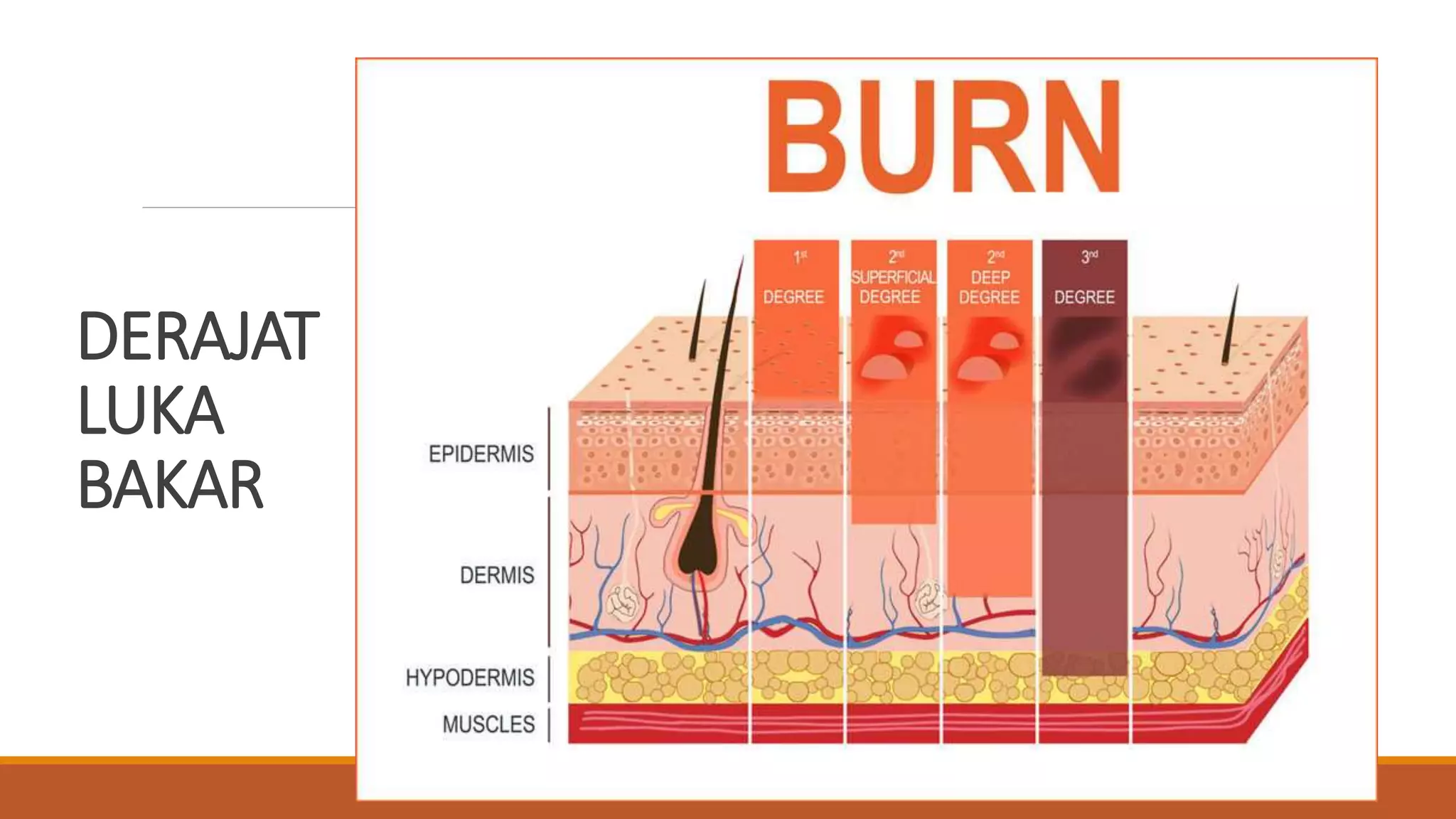 Materi 1_Konsep luka bakar.pptx