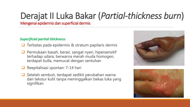 Materi 1_Konsep luka bakar.pptx