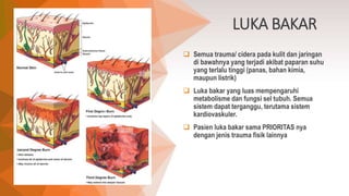 Materi 1_Konsep luka bakar.pptx