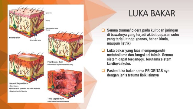 Materi 1_Konsep luka bakar.pptx