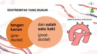 MATERI 4 - Pengukuran Saturasi Oksigen .pptx