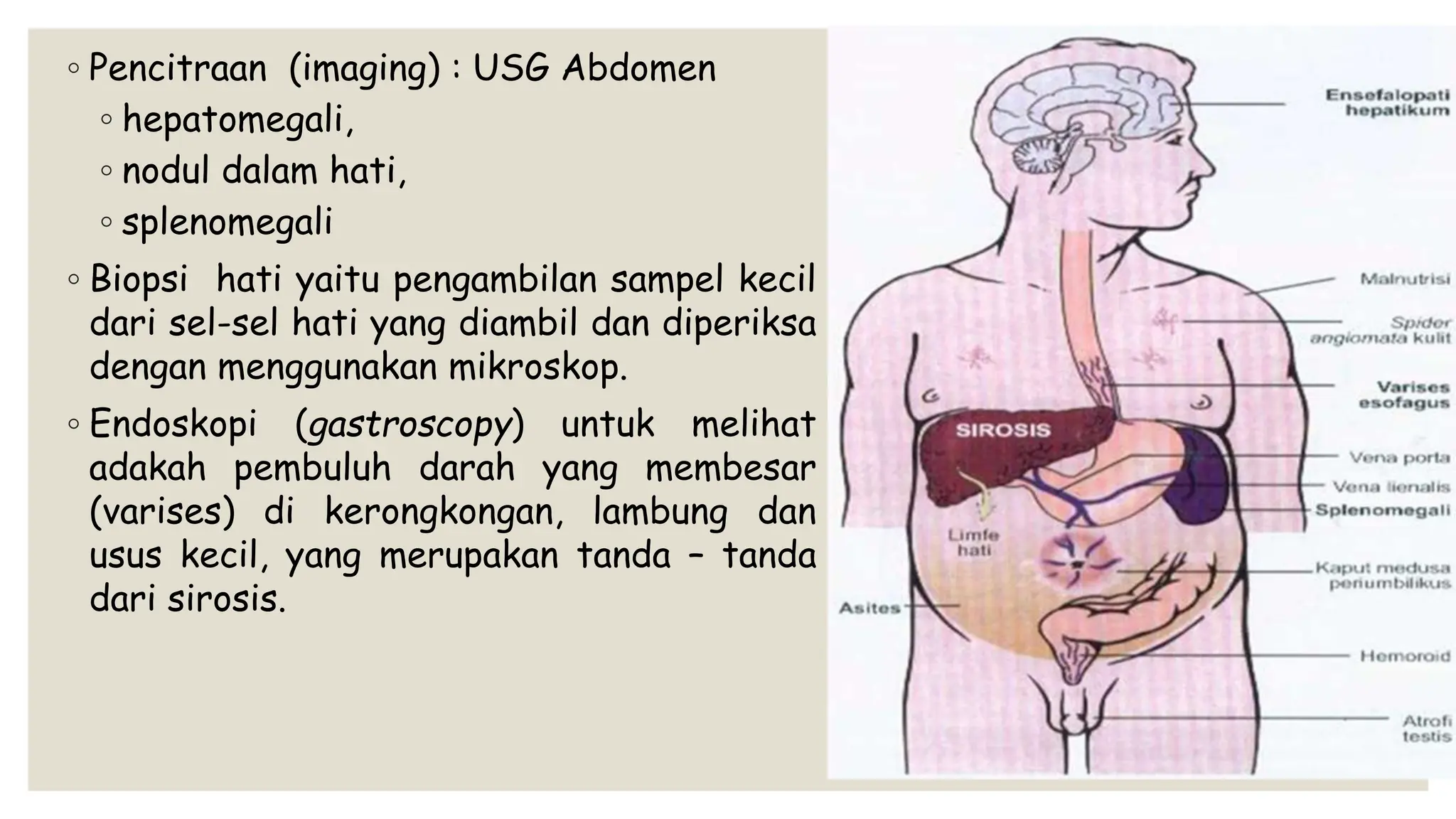 Materi 5.2 ASKEP DGN SIROSIS_HEPATIS.pptx