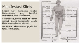 Materi 5.2 ASKEP DGN SIROSIS_HEPATIS.pptx