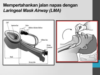 Materi 5 AIRWAY AND BREATHING MANAGEMENT.pptx