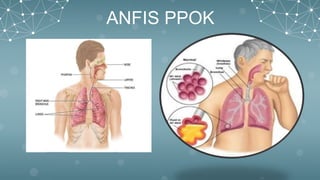 Materi 5 Askep PPOK.pptx